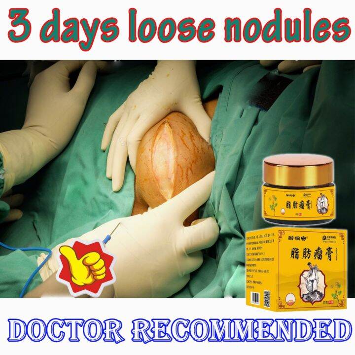 HOT SALElaobooy2482 bukol cream lipoma 50g gamot sa bukol japan herbal cream lipoma cream ...