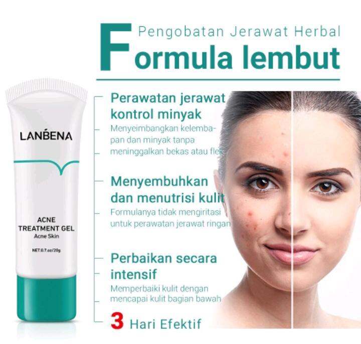 LANBENA Acne gel / Acne Skin 20gr Original | Lazada Indonesia