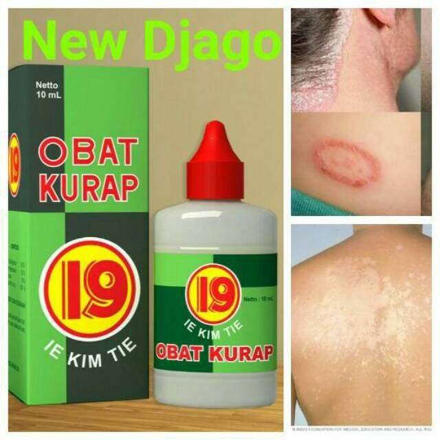 Obat Kurap CAP 19 Obat Kulit Cair Kadas Kurap Panu Kutu Air 10ml | Cap ...