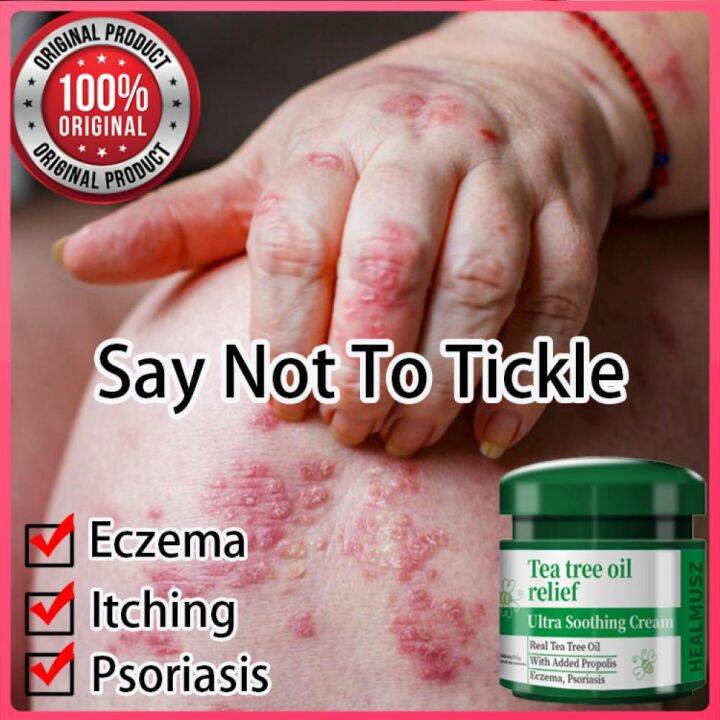 【COD】Psoriasis Ointment Eczema Ointment Antibacterial Ointment Skin ...