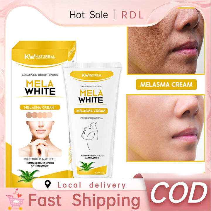 [BUY 1 TAKE 1]MELASMA CREAM 50g [FDA APPROVED] FOR PEKAS, FRECKLE ...