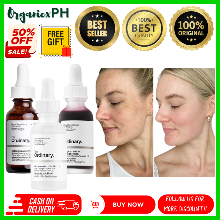 🌺👉 ORIGINAL 💯 AUTHENTIC The Ordinary 3 in 1 Set Serum Niacinamide 10% ...