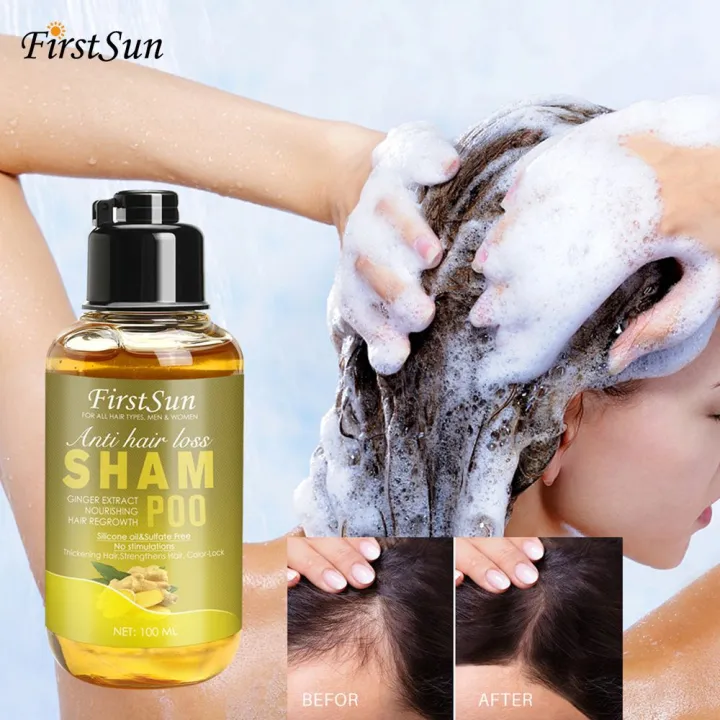 Firstsun Ginger Anti Dandruff Shampoo Anti Hair Loss Bald Hair Growth