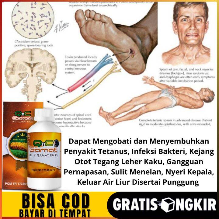 Obat Penyakit Tetanus , Pengering Luka di Kaki, Infeksi Bakteri ...