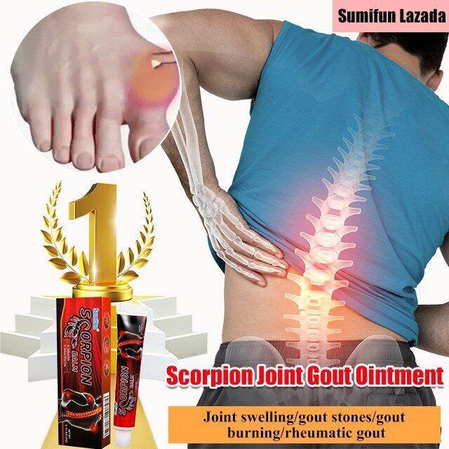 vivi lifestyle Scorpion Joint Gout Ointment | Lazada PH