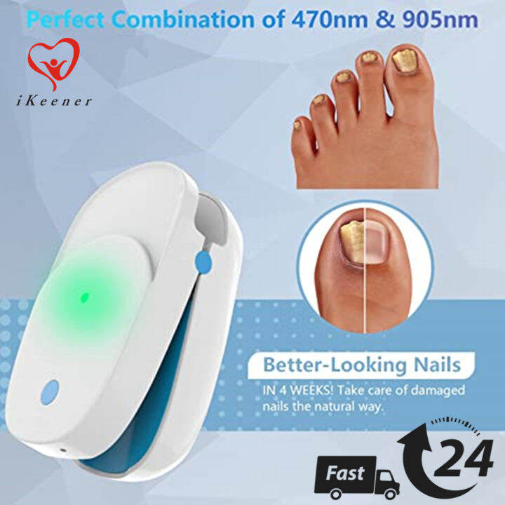 iKeener Infrared light therapy Portable Nails Fungus Laser Device ...