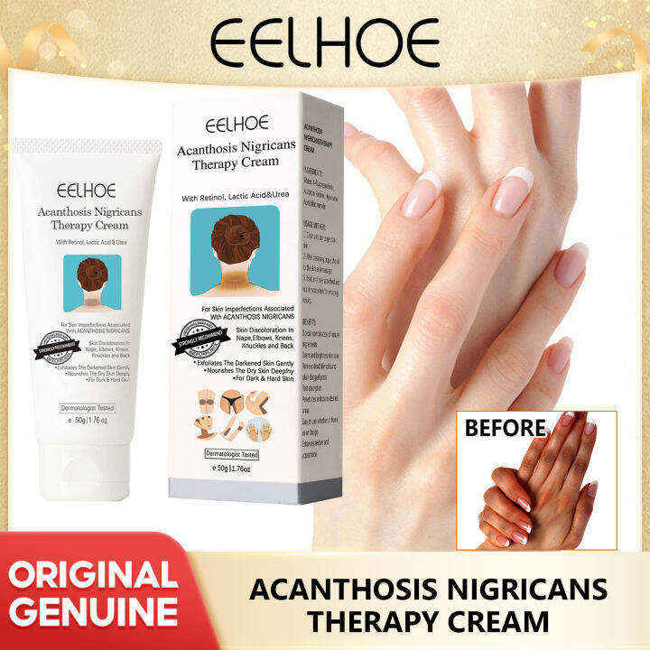 Eelhoe Black Spine Skin Repair Cream for Underarm, Arm, Knee Joint ...