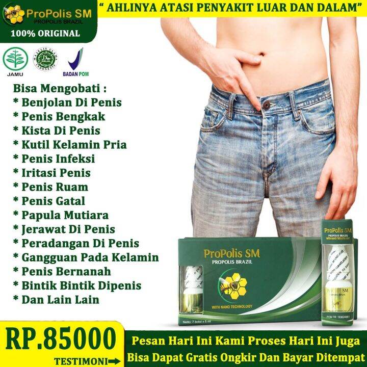 Obat Untuk Benjolan Di Penis Kutil Kelamin Pria Penis Bengkak Kista Di ...