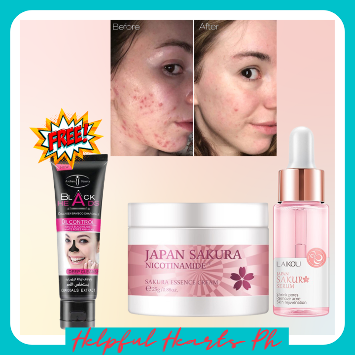 Sakura Cream + Sakra Serum Whitening Dark Spot Remover Essence ...
