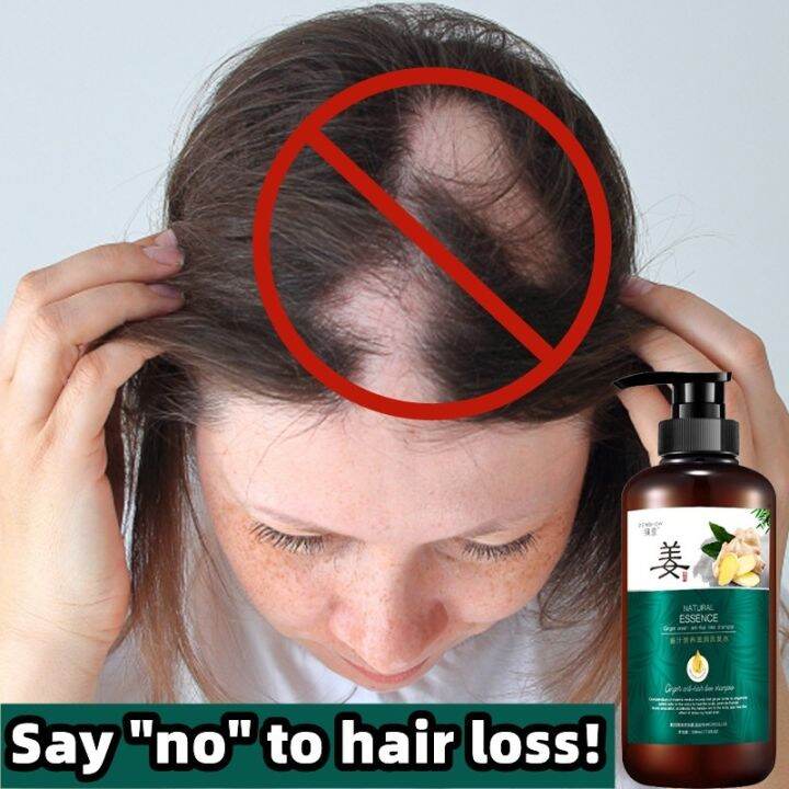 【COD】 Ginger shampoo scalp treatment anti alopecia promote hair growth ...