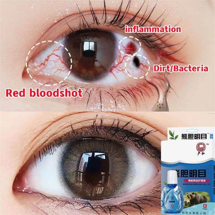 Eye drops lutein bear bile eye drops for aging tears eye protection ...