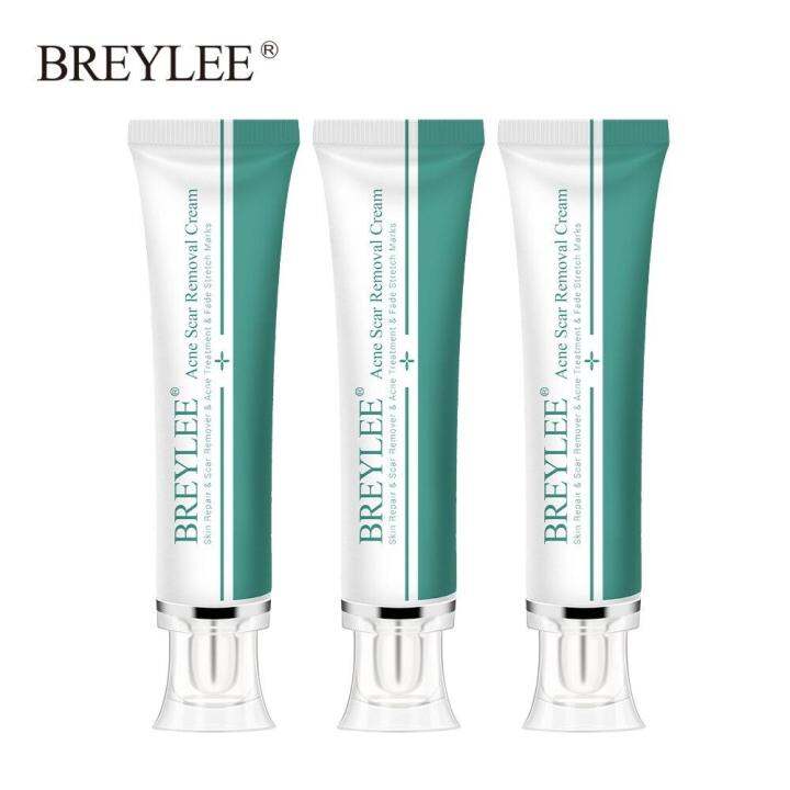 BREYLEE ACNE SCAR REMOVAL CREAM 30G FACE CREAM SKIN REPAIR SKIN CARE SCAR ACNE TREATMENT REMOVE ...