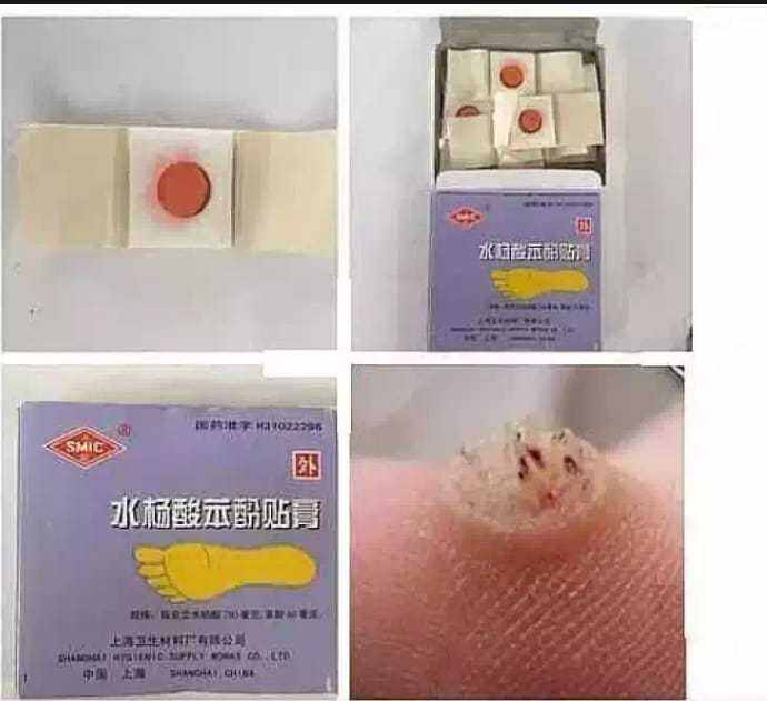 Plester Kutil / plaster Mata ikan /kapalan | Lazada Indonesia