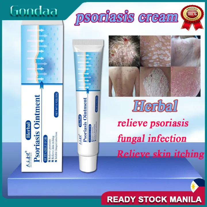 100% Original Authentic Psoriasis Ointment Psoriasis Treatment Cream eczema treatment cream ...
