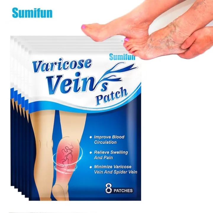 Sumifun Varicose Veins Patch Treat Phlebitis Vasculitis Sticker Thigh ...