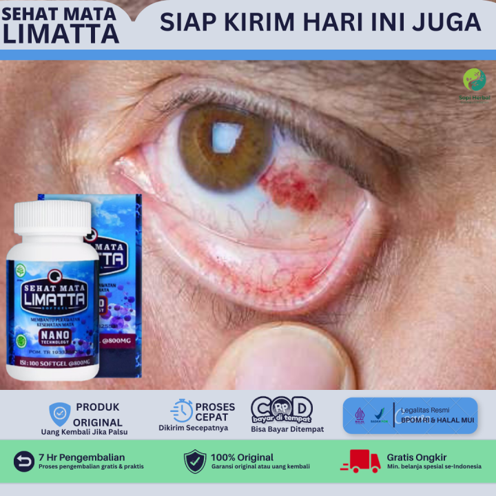 Saraf Mata Putus, Saraf Mata Rusak Dan Bengkak, Mata Minus, Mata ...