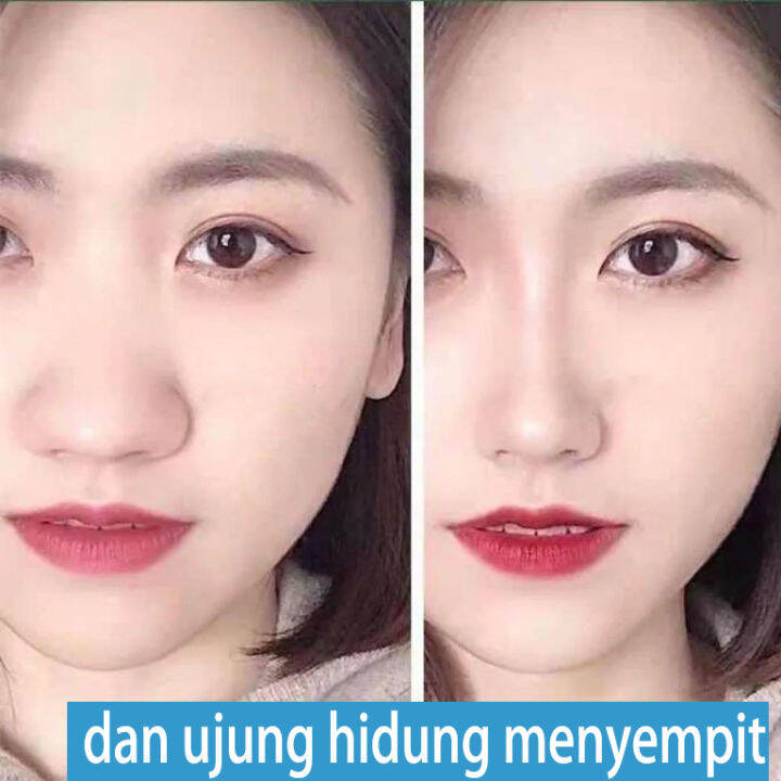 [hasil cepat hidung cantik] hidung menjadi kecil/ batang hidung menjadi ...