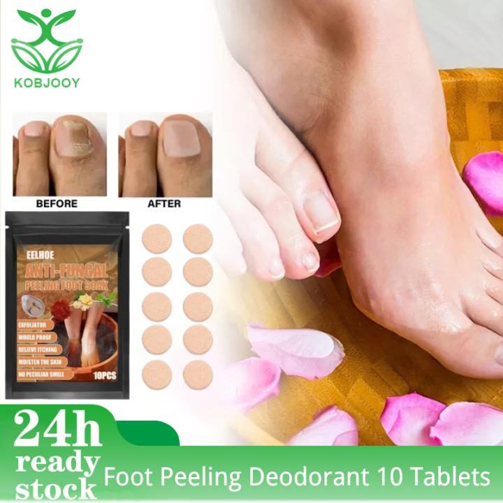 Fungal nail treatment, foot detoxification, foot skin crack relief ...