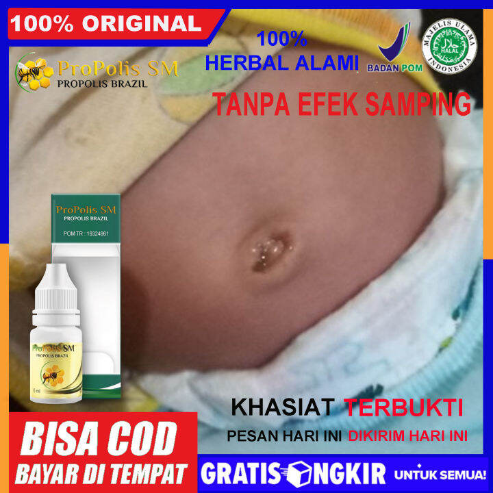 Obat Infeksi Tali Pusar Yang Aman, Mengatasi Infeksi Pusar, Puser ...