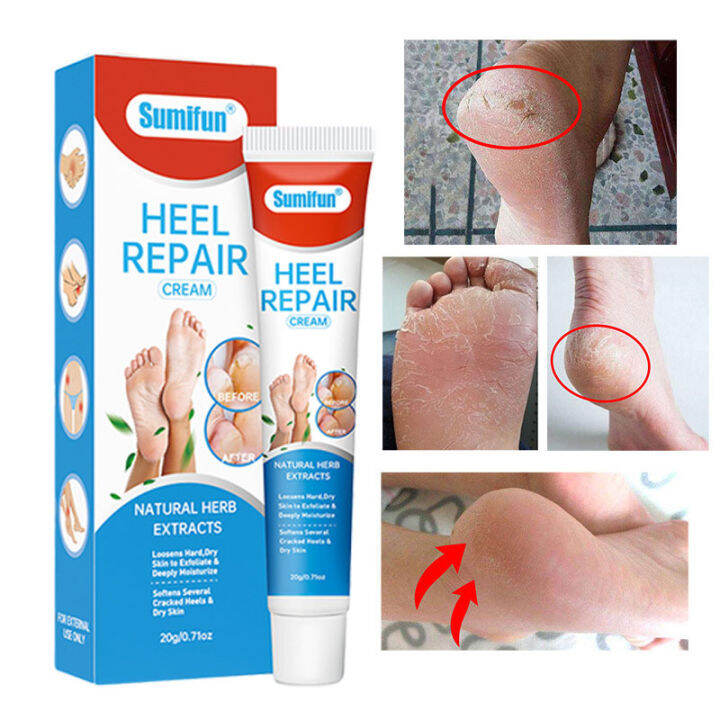 (Super Moisturizing) Sumifun Foot Cream For Dry And Cracked Heels Foot ...