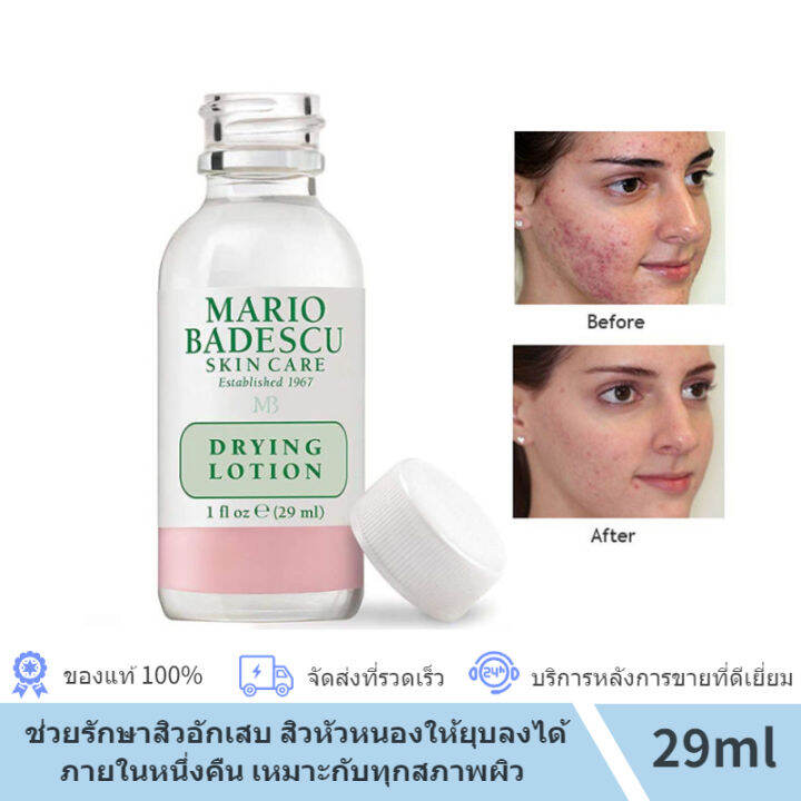 Mario Badescu DRYING LOTION American Acne Treatment Essence 29ml ...