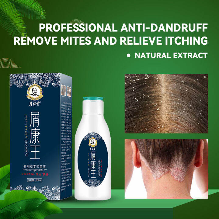 210ml Anti Dandruff Scalp Treatment Shampoo Super Effective Herbal ...