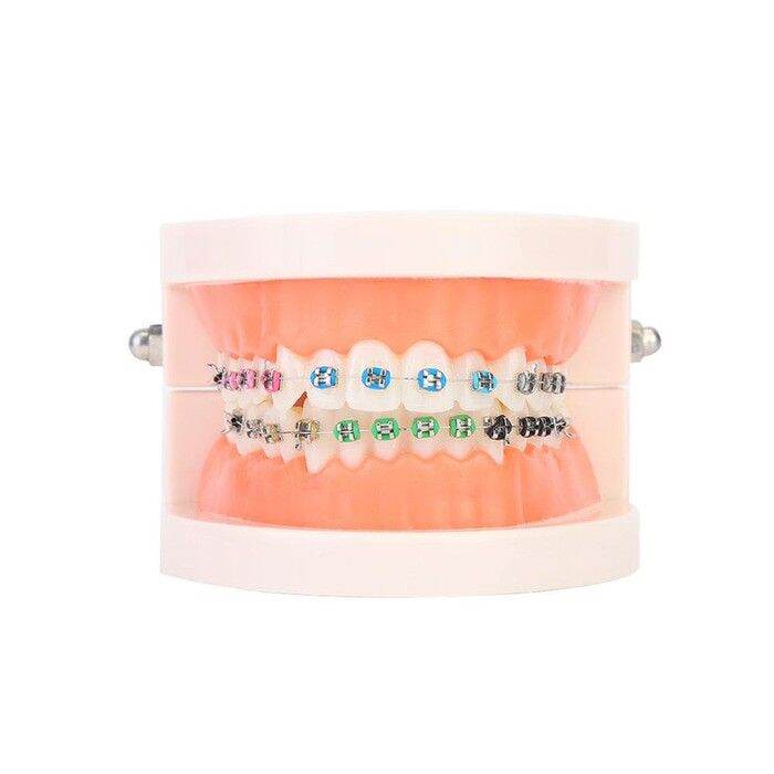 Dental model ortho study model orthodontic phantom studi behel braces ...