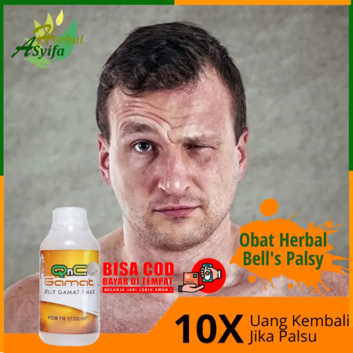 Obat Herbal Bell's Palsy, Obat Stroke Ringan, Mulut Mencong Sebelah ...