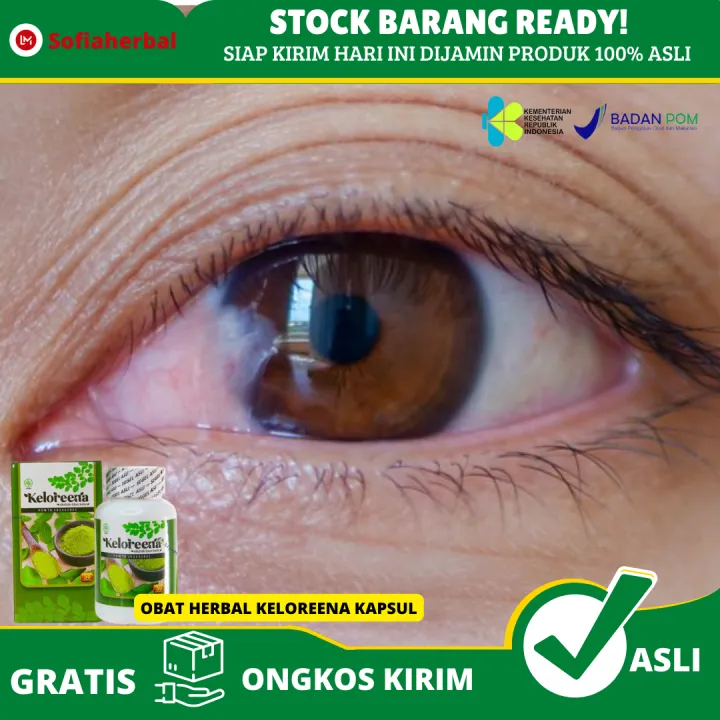 Obat Mata Berlemak, Obat Pterigium, Obat Penghilang Lamad Pada Selaput ...