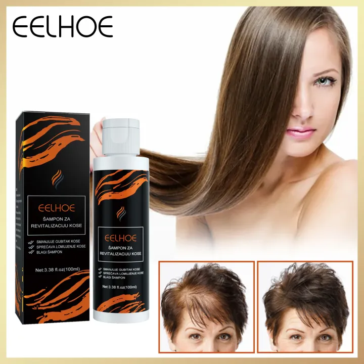 Eelhoe Anti Hair Loss Shampoo Natural Healthy Moisturizing Itching ...