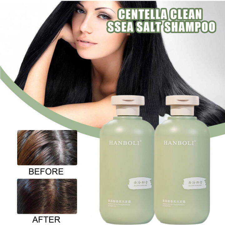 Original Anti Dandruff shampoo, Dandruff Remover, Anti Fungal, Anti ...