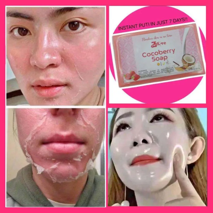 NO NEED DERMA TRENDING NA SABON NA PAMPAKINIS AT PAMPAPUTI IN JUST 1-2 WEEKS LANG! ZAFYRE ...