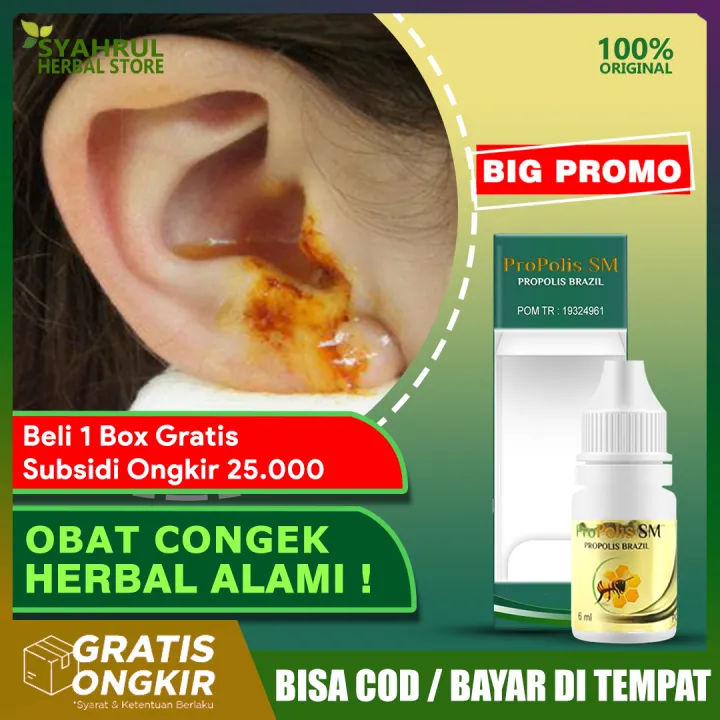 Obat Atasi Congek - Budeg - Gendang Telinga - Telinga Berdenging ...