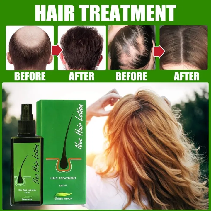 【COD & Ready Stock】120ML Unisex NEO Hair Regrowth Lotion Haircare ...