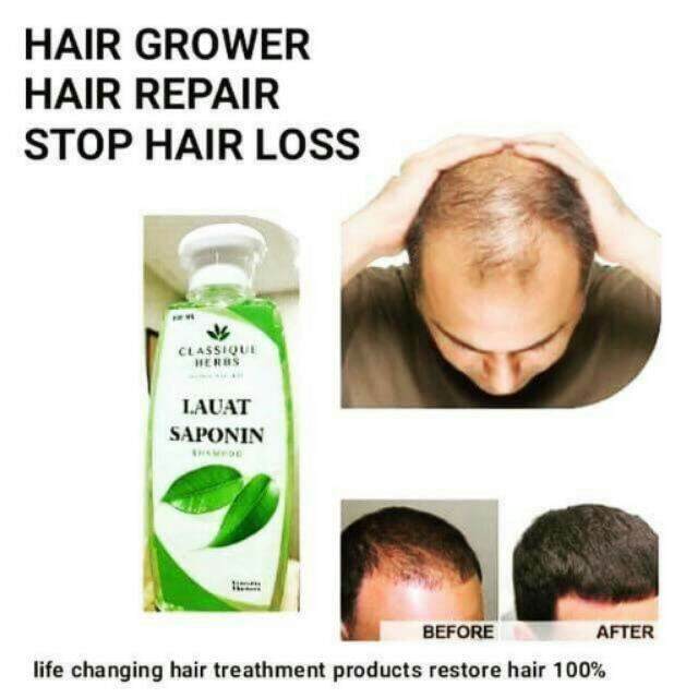 Lauat Shampoo | Hair Loss | Herbal Shampoo | Hair Grower | Anti ...