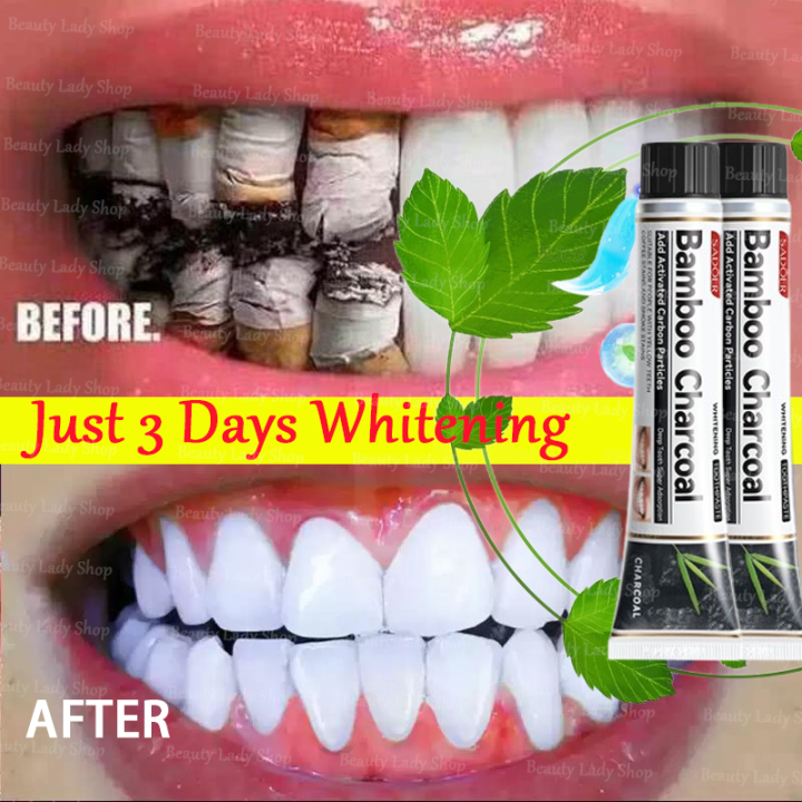 Bamboo Charcoal Toothpaste Whitening Teeth Original 100g Teeth ...