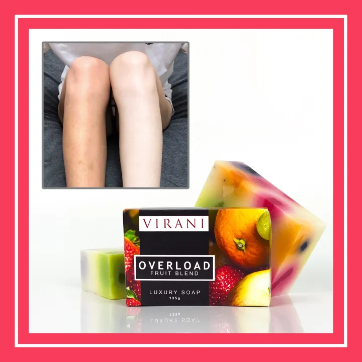 Overload Fruit Extract Glutathione Whitening Soap Gluta Kojic Bleaching ...