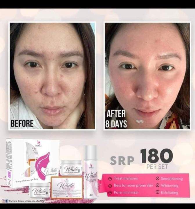 For Glowing Skin Try The New Pamela Rejuvenating Set White | Lazada PH