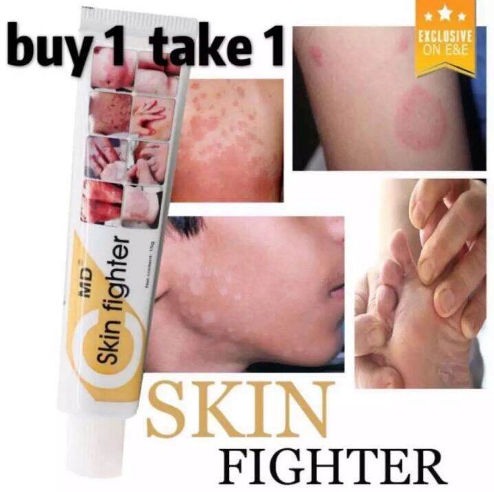 ( set of 2 ) MD Skin Fighter 15g ORIGINAL | Lazada PH
