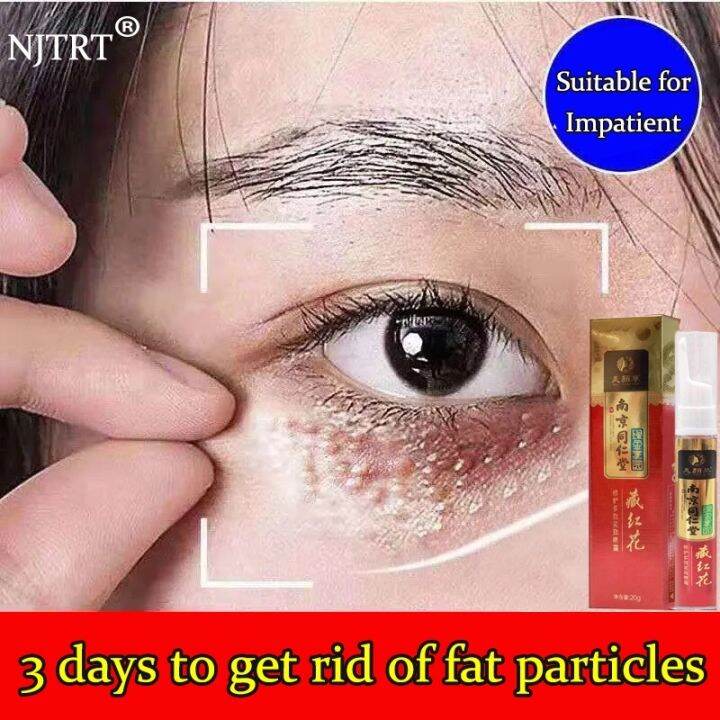 NJTRT Eye Cream Original 20g Eyebag And Dark Circle Remover Remove Eyes ...