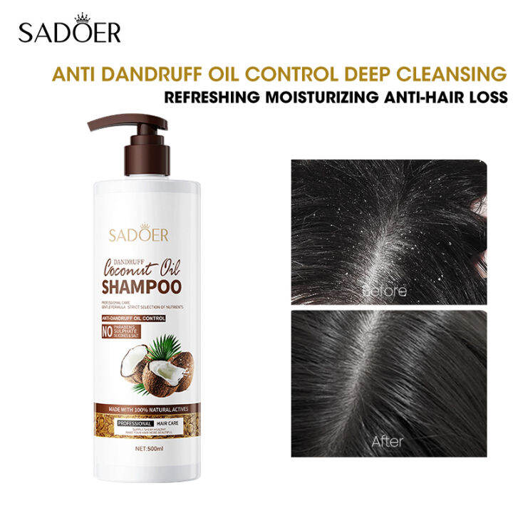 SADOER Coconut Oil Shampoo Moisturizing Hair Care Dandruff Shampoo Refreshing Oil Control ...