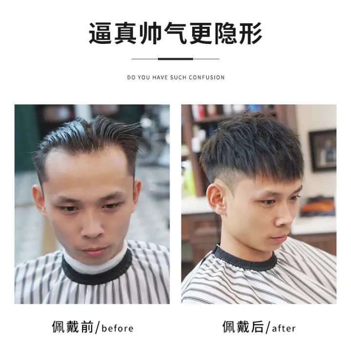 Men's hairline fake hair stickers forehead men's high forehead bald wig ...