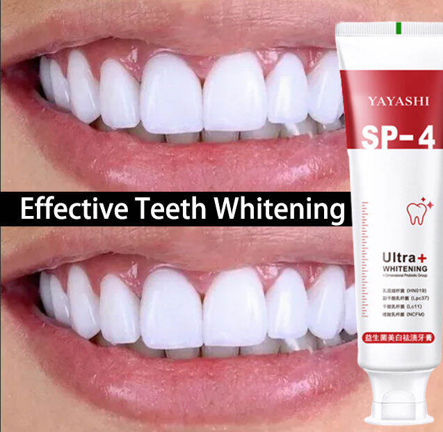 SP4 Authentic Fresh Oral Probiotic Toothpaste, Brightening & Stain ...