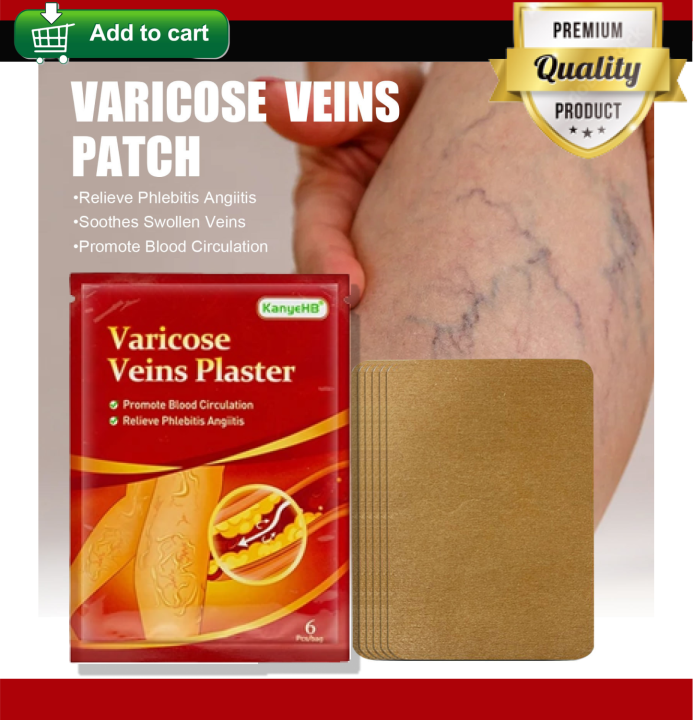 Varicose Vein Patch Pain Relief | Lazada PH
