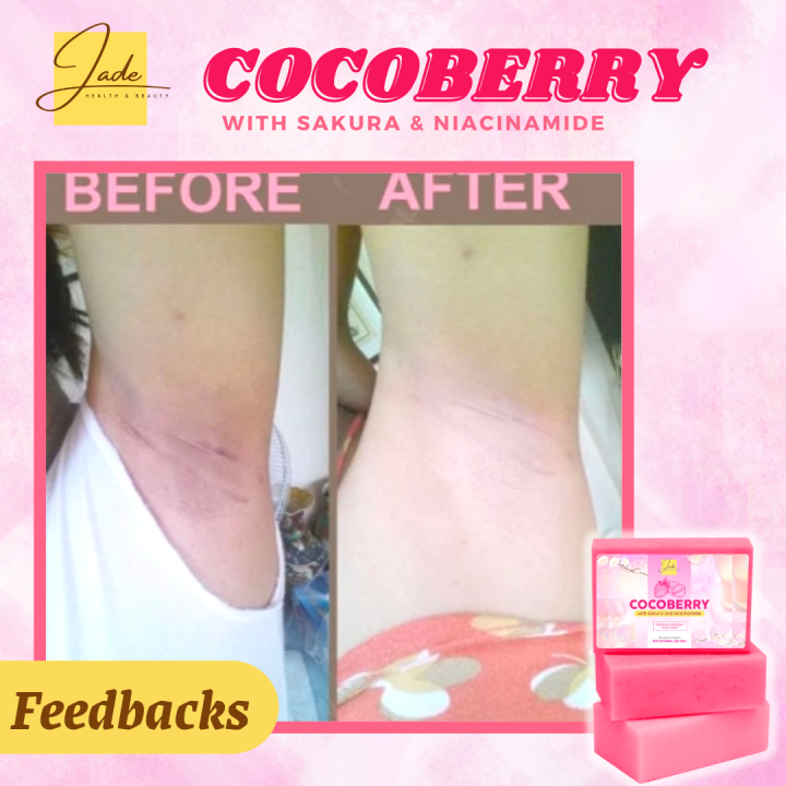 Premium Cocoberry with Sakura and Niacinamide Original Whitening Body Soap 7 Blessed Shop Ph 11 ...