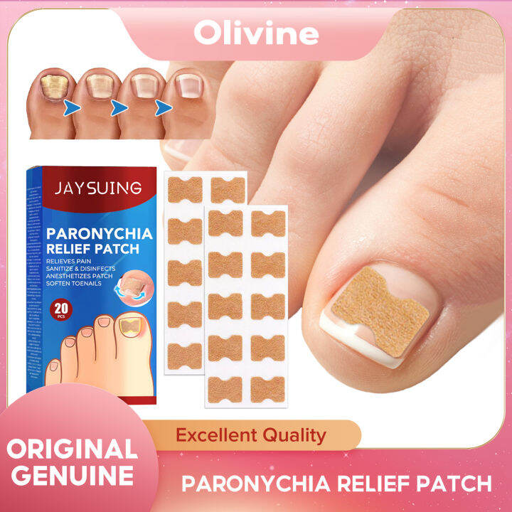 Jaysuing Nail Fungus Treatment Patches Ingrown Toenail Treatment Anti Paronychia Oils Pain ...