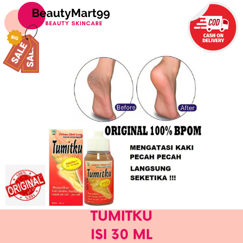 TUMITKU Spesial Mengobati Kaki Pecah Pecah Terbaik dan Termurah Mudah ...