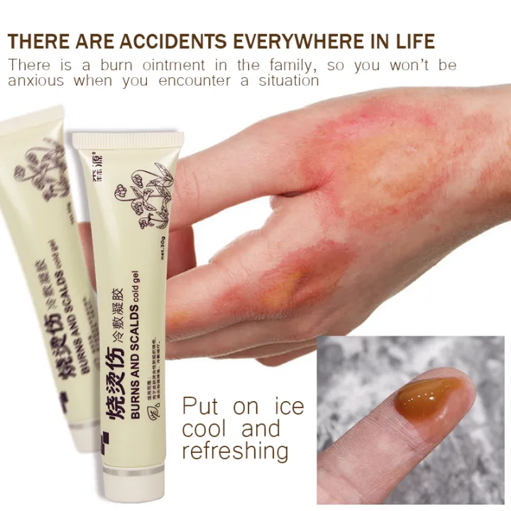 (100% genuine) 30 grams of household burn cream, anti-infection and ...