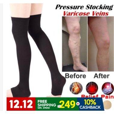 【lucai+COD】Compression Socks Thight High pressure Open Toe Varicose ...