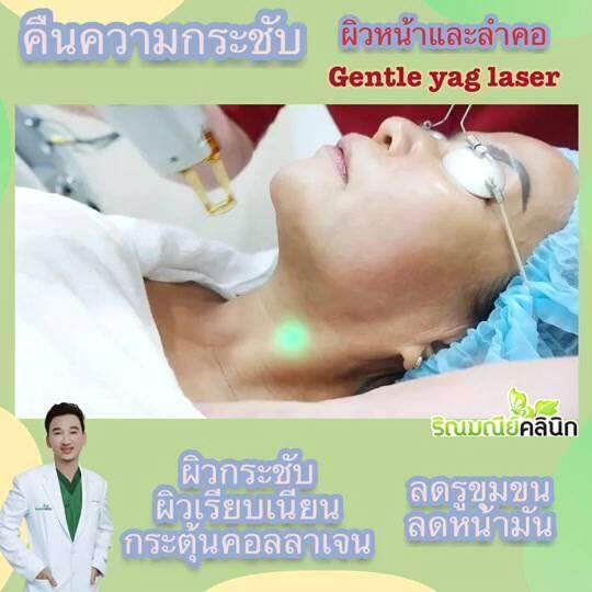 🙏promotion เลเซอร์หน้า Gentle Yag Reju เลเซอร์ Long Pulse Nd:YAG ปรับ ...